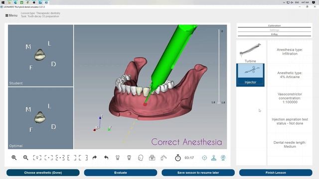 Стоматологический симулятор с добавленной реальностью