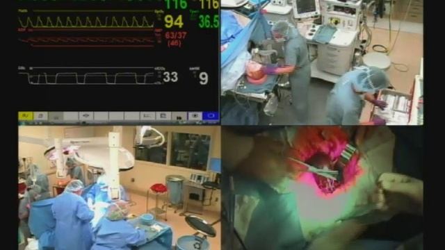 Командное обучение в симулированной операционной