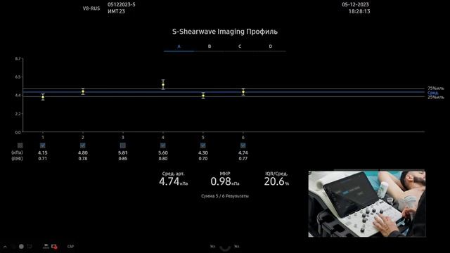 Современные технологии УЗ-оценки диффузных заболеваний печени на УЗ-сканере Samsung V8
