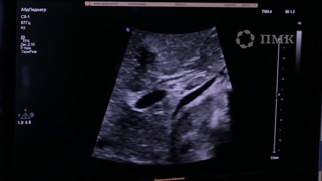 Видеообзор аппарата УЗИ Philips EPIQ Elite. Клинические возможности.