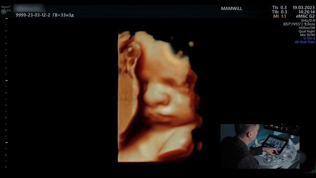 Видеообзор аппарата УЗИ от General Electric, модель Voluson E10