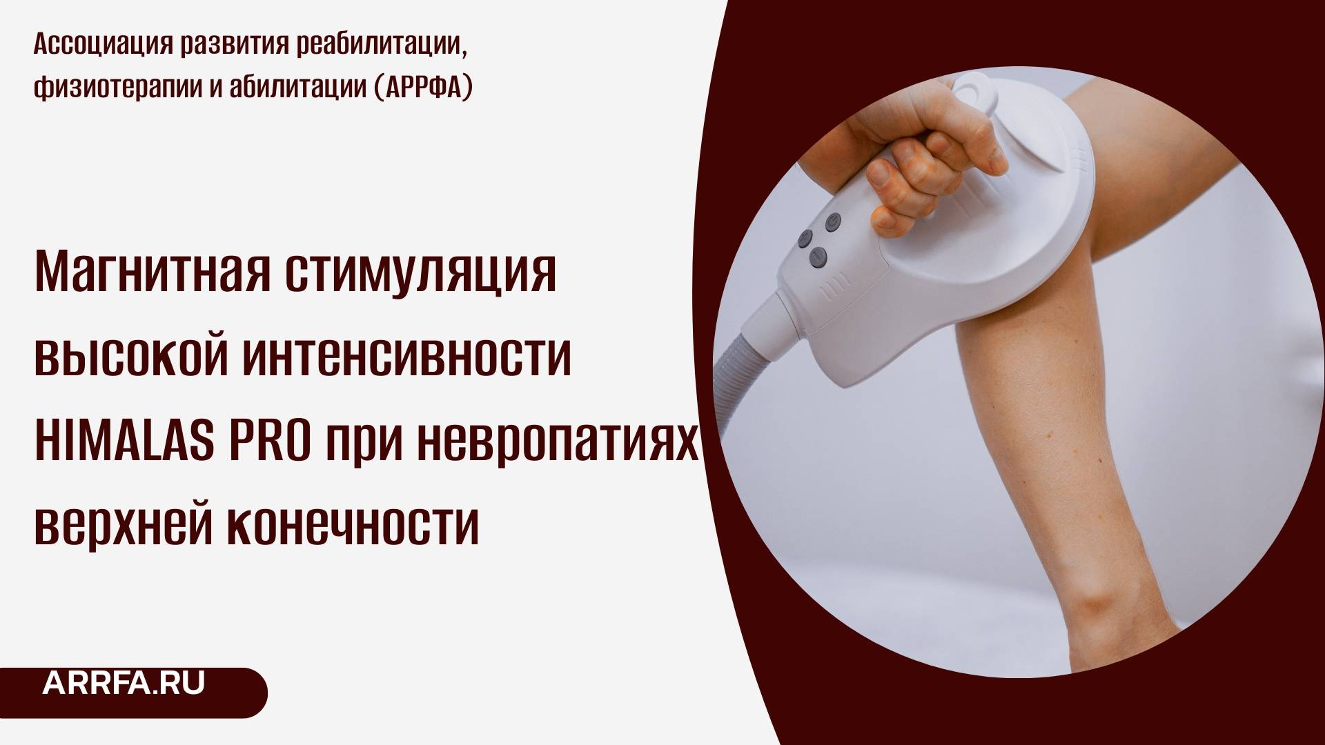Магнитная стимуляция высокой интенсивности HIMALAS PRO при невропатиях верхней конечности