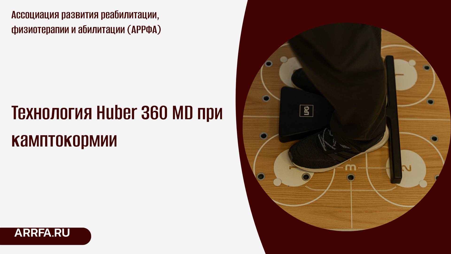 Технология Huber 360 MD при камптокормии