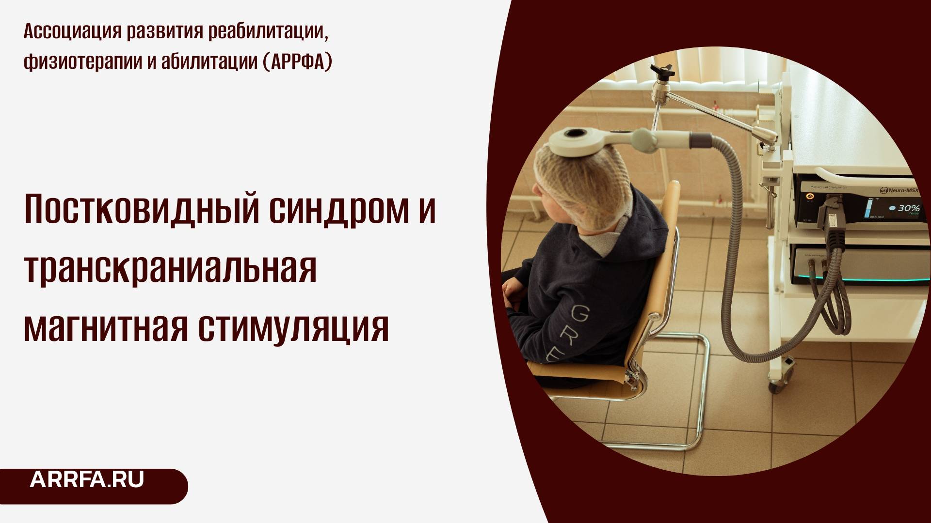 Постковидный синдром и транскраниальная магнитная стимуляция