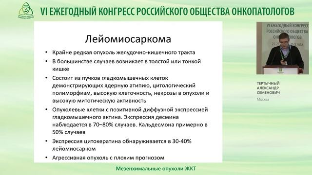 Мезенхимальные опухоли ЖКТ