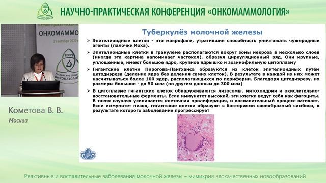 Реактивные и воспалительные заболевания молочной железы – мимикрия злокачественных