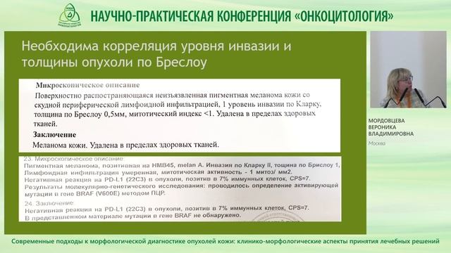 Современные подходы к морфологической диагностике опухолей кожи
