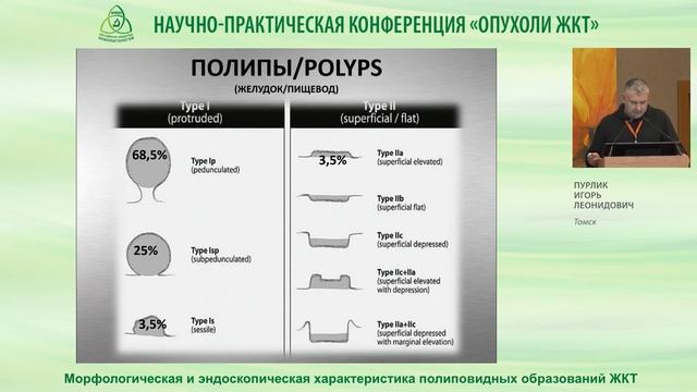Морфологическая и эндоскопическая характеристика полиповидных образований ЖКТ