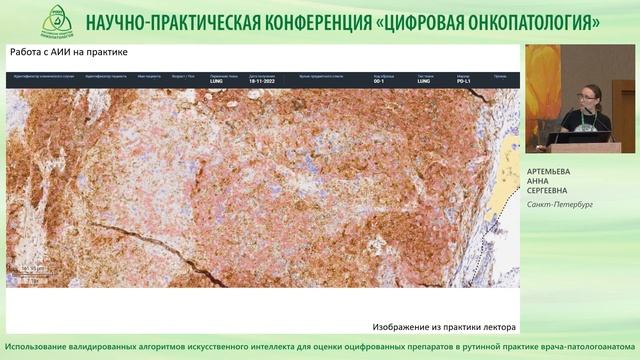 Использование валидированных алгоритмов искусственного интеллекта для оценки оцифрованных препаратов