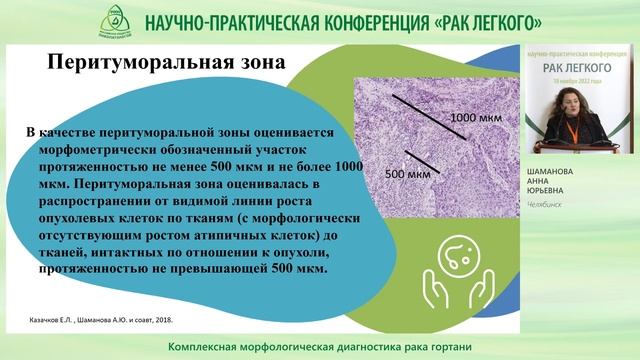 Комплексная морфологическая диагностика рака гортани