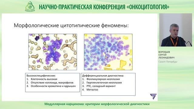 Медуллярная карцинома щитовидной железы – критерии морфологической диагностики