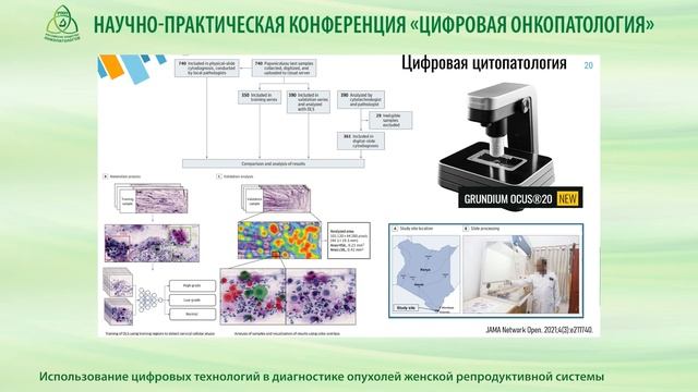 Использование цифровых технологий в диагностике опухолей женской репродуктивной системы