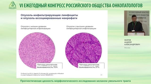 Прогностическая ценность морфологического исследования меланом увеального тракта