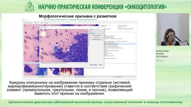 Цитологическая диагностика заболеваний молочной железы – искусственный интеллект