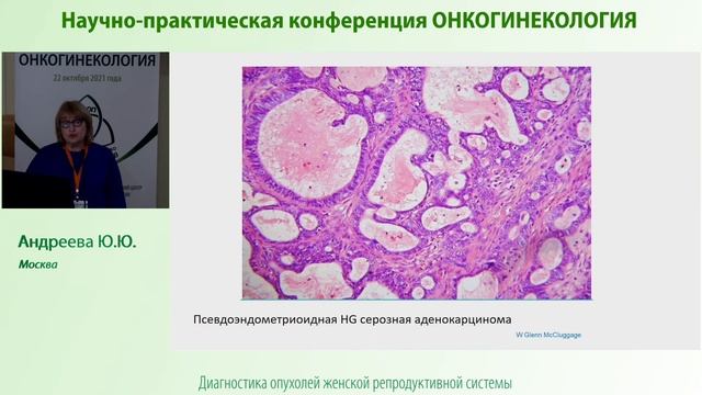 Подготовка гистологических образцов рака яичника к молекулярно-генетическому исследованию