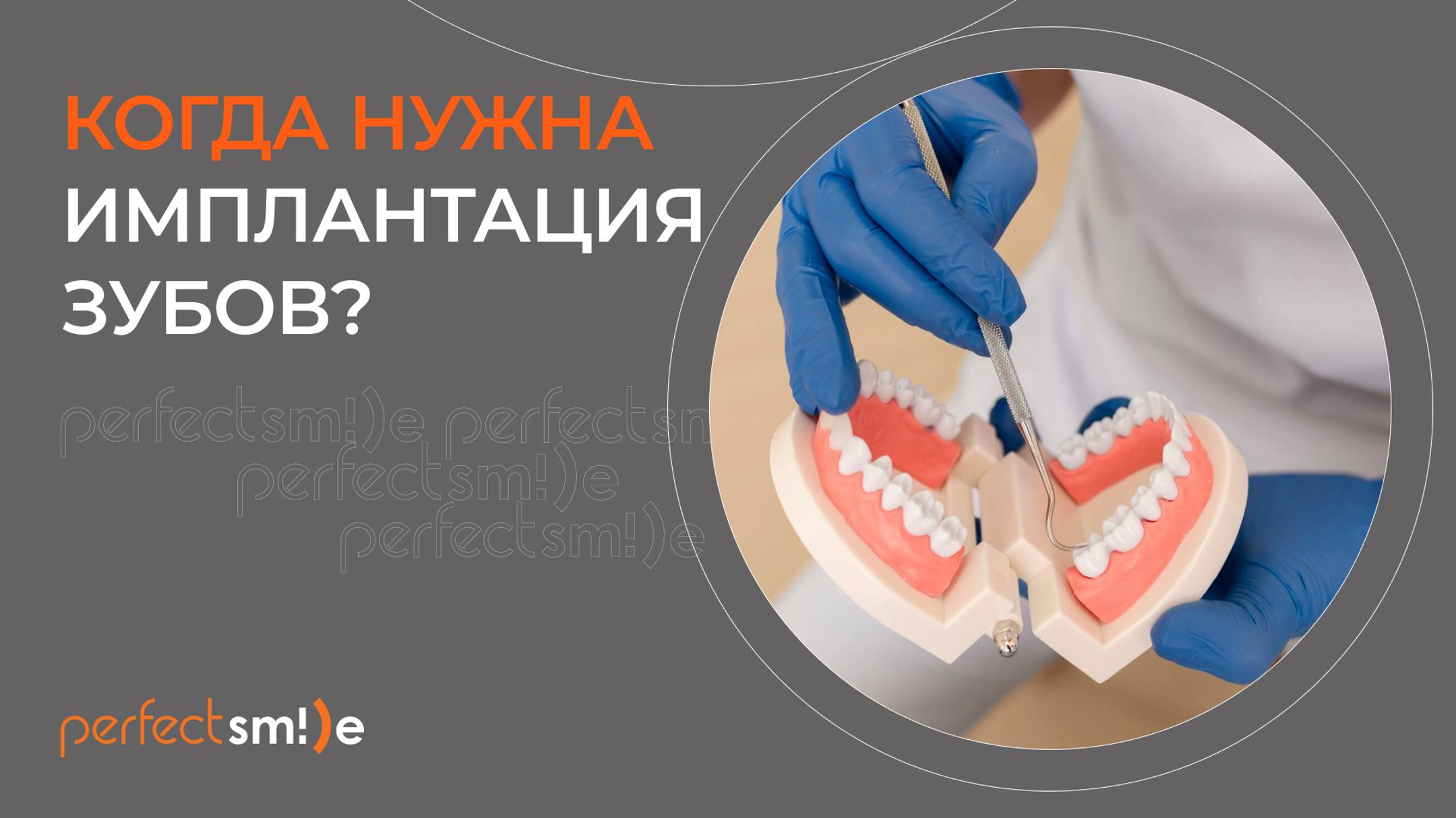 👉  Имплантация All-on-4 и All-on-6: когда показана?