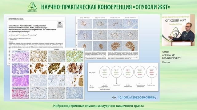 Нейроэндокринные опухоли желудочно кишечного тракта