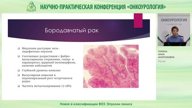 Новое в классификации ВОЗ  Опухоли пениса