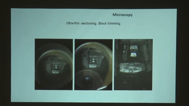 Голышев С.А. - Физические методы биохимии - 8. Электронная микроскопия