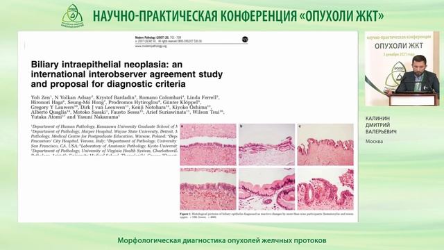 Морфологическая диагностика опухолей желчных протоков