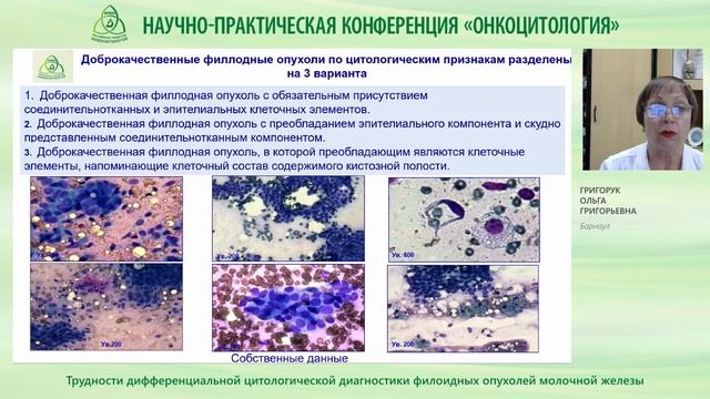 Трудности дифференциальной цитологической диагностики филоидных опухолей молочной железы