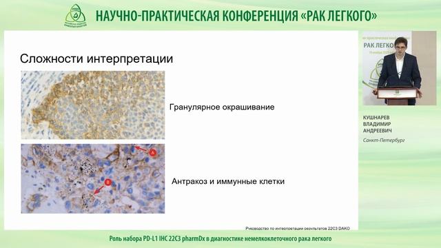 Роль набора PD-L1 IHC 22C3 pharmDx в диагностике немелкоклеточного рака легкого