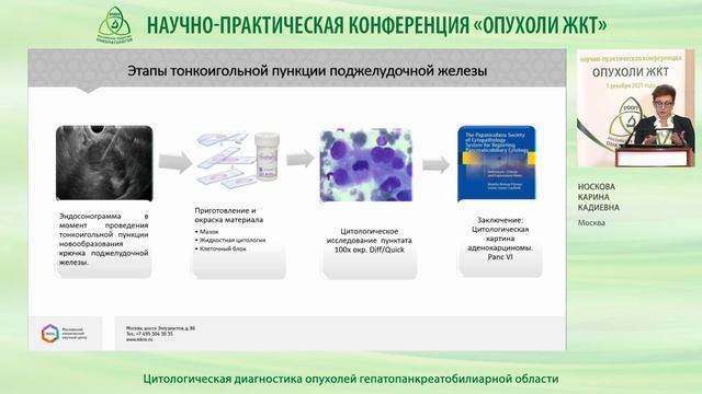 Цитологическая диагностика опухолей гепатопанкреатобилиарной области