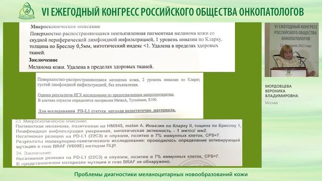 Проблемы диагностики меланоцитарных новообразований кожи