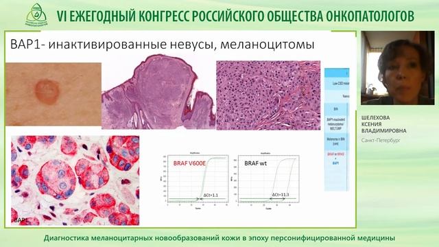 Диагностика меланоцитарных новообразований кожи в эпоху персонифицированной медицины