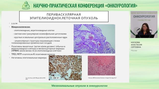 Мезенхимальные опухоли в онкоурологии
