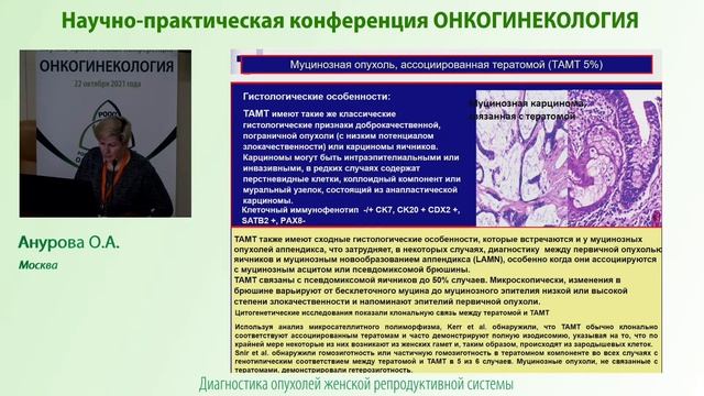 Дифференциальная диагностика муцинозных опухолей яичников
