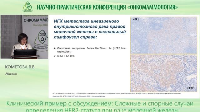 Молекулярная гетерогенность мультицентрического рака обеих молочных желез