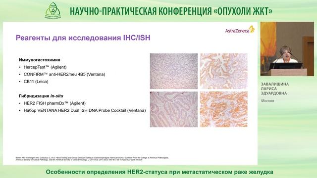 Особенности определения HER2 статуса при метастатическом раке желудка