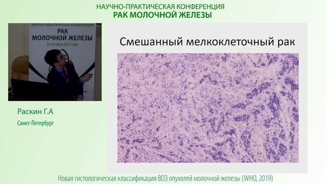 Нейроэндокринные опухоли молочной железы