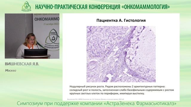 Ацинарно клеточная HER2 позитивная карцинома молочной железы