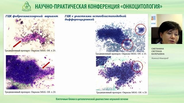 Клеточные блоки в цитологической диагностике опухолей печени