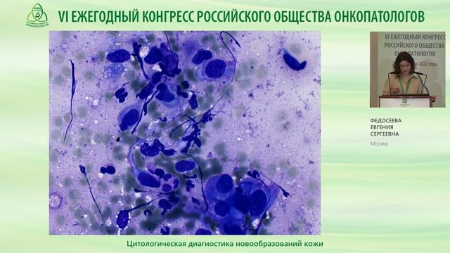 Цитологическая диагностика новообразований кожи