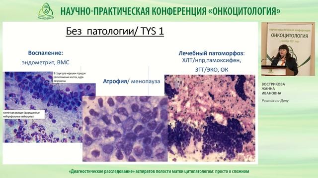 «Диагностическое расследование» аспиратов полости матки цитопатологом: просто о сложном
