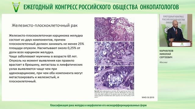 Классификация рака желудка и морфология его низкодифференцированных форм