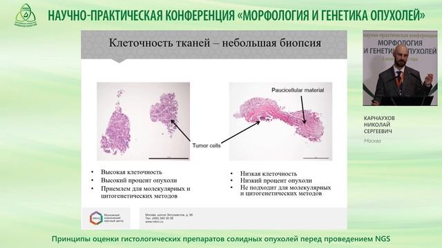 Принципы оценки гистологических препаратов солидных опухолей перед проведением NG