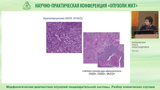 Морфологическая диагностика опухолей пищеварительной системы  Разбор клинических случаев