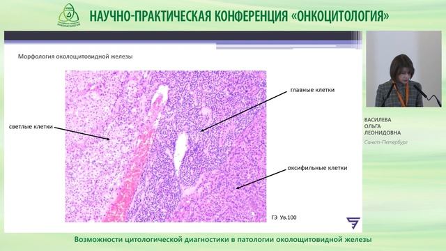 Возможности цитологической диагностики в патологии околощитовидной железы