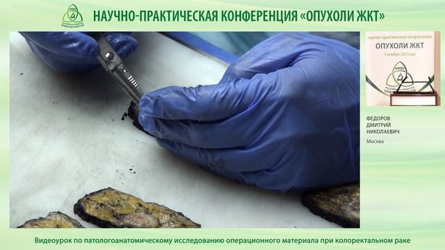 Видеоурок по патологоанатомическому исследованию операционного материала при колоректальном раке
