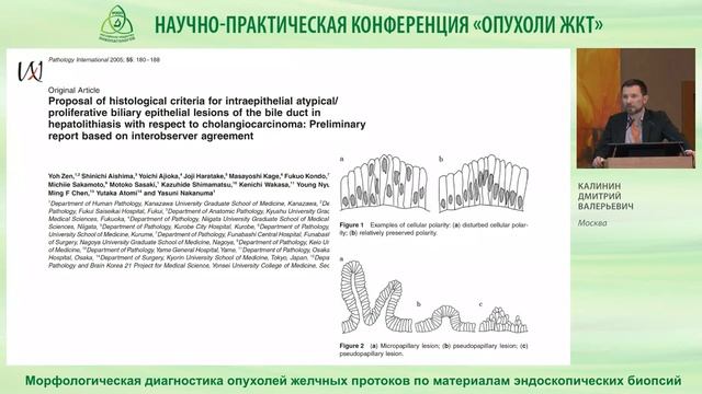 Морфологическая диагностика опухолей желчных протоков по материалам эндоскопических  биопсий