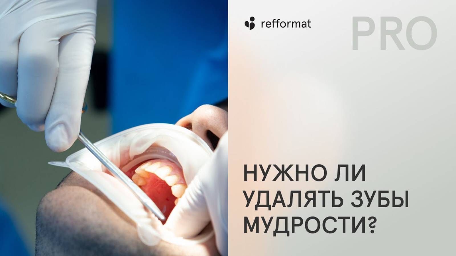 👨⚕️ Нужно ли удалять зубы мудрости, если они не беспокоят?