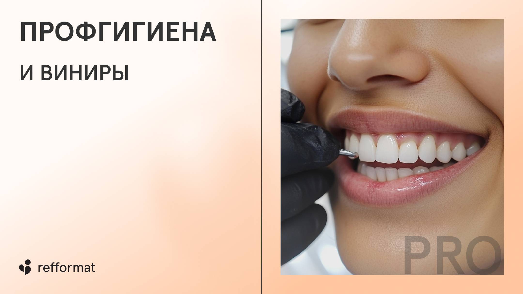 👄 Профгигиена: можно ли делать, если установлены виниры?