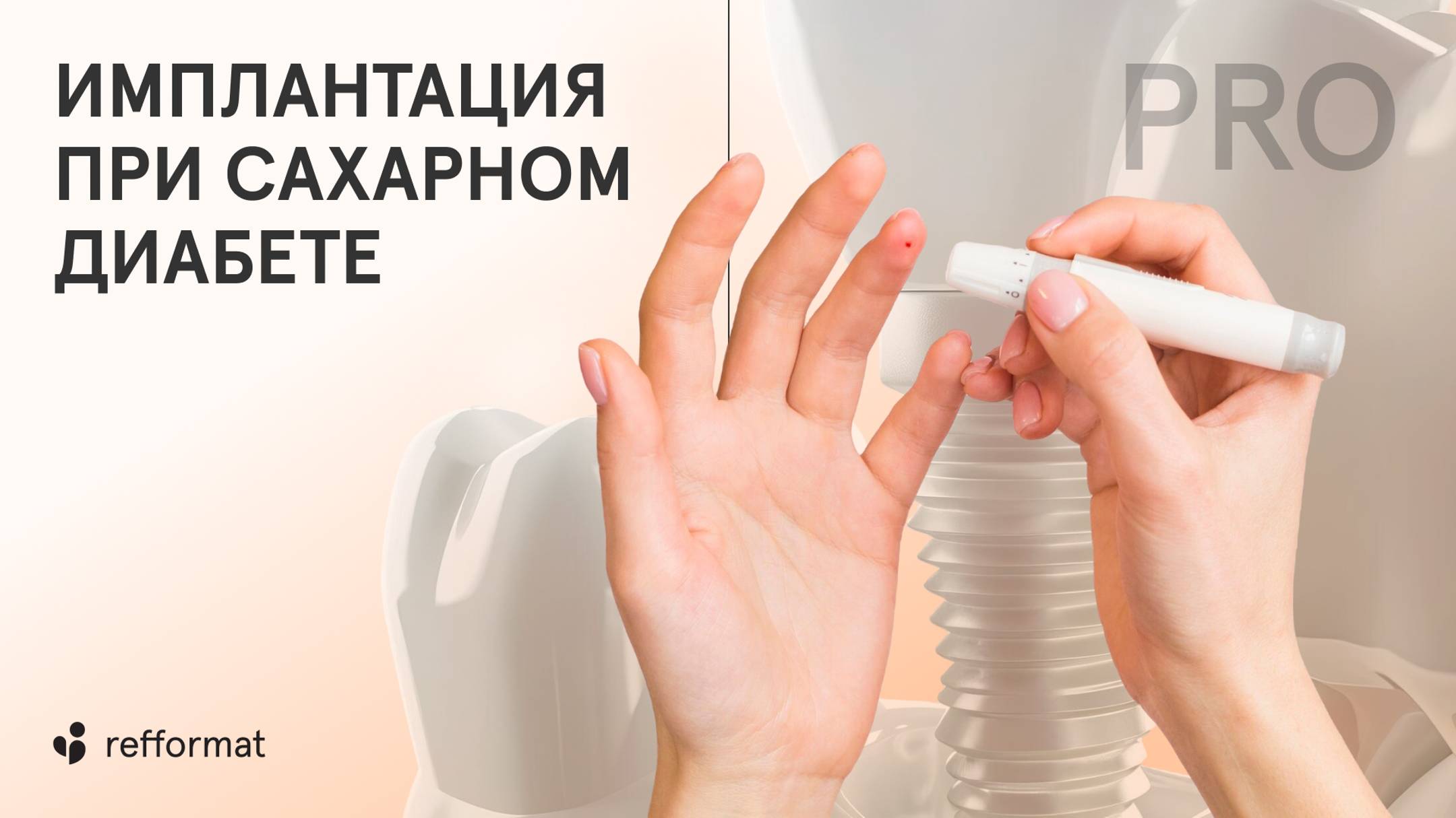 👋 Имплантация при сахарном диабете: возможна ли?