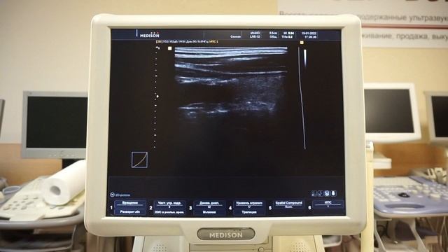 Medison SonoAce X8 обзор ультразвукового сканера
