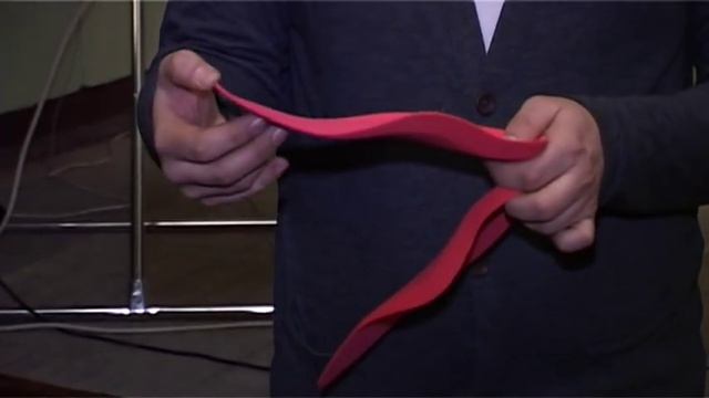 520.03 Сколиоз Девочка18л.Ортез ФормТотикс.Клинич. случай