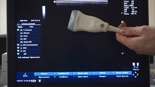 GE Logiq P6 обзор ультразвукового сканера